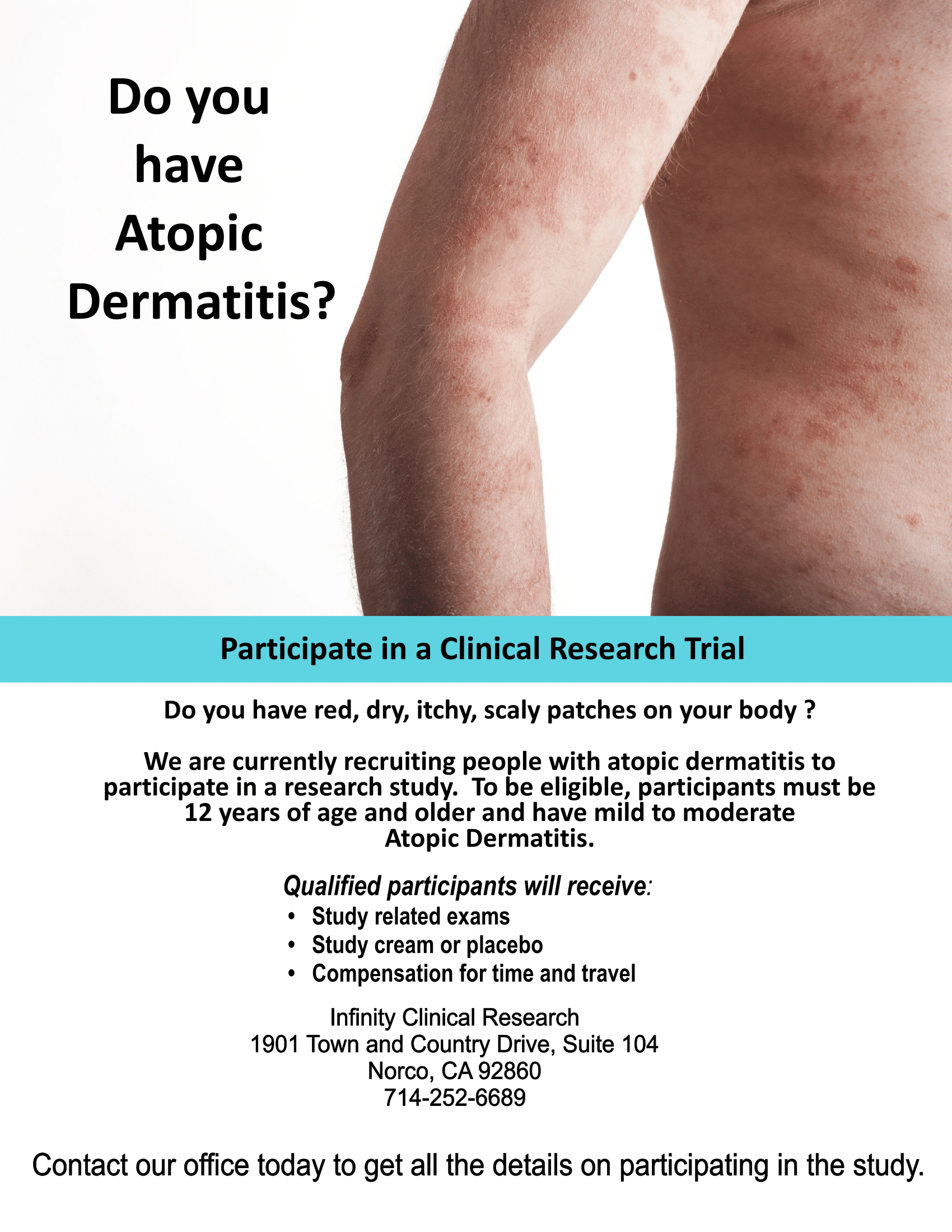 Atopic Dermatitis - Infinity Clinical Research